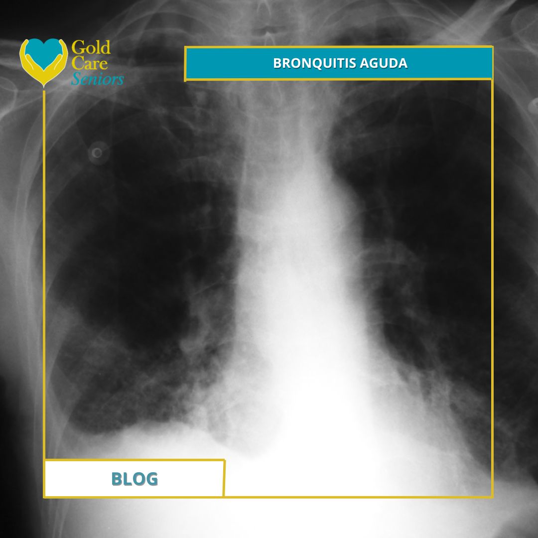 Bronquitis aguda - Gold Care Seniors